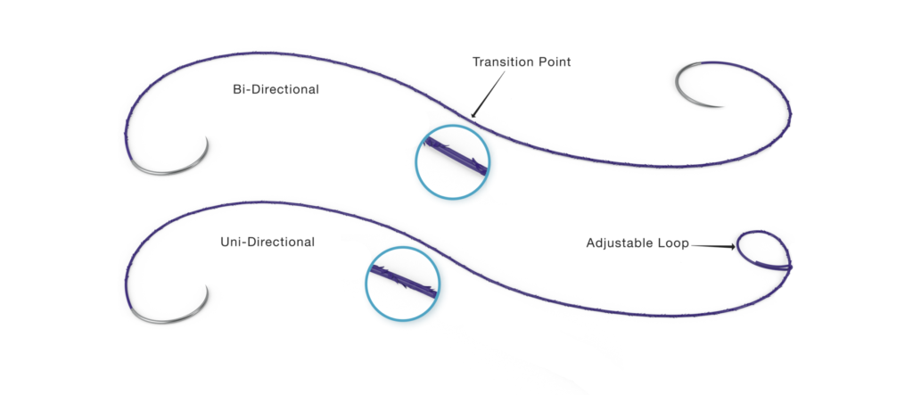 Quill Monoderm – SilverGlide™